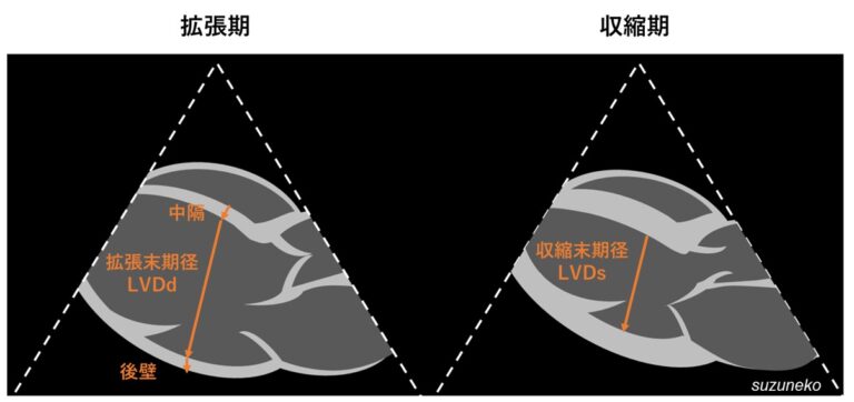 teichholz法とmodified simpson法 _ 心エコー図学会 ガイドライン – ZSMF