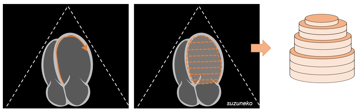 心エコーでの左室収縮機能(LVEF)の評価について | 循環器内科すずねこのブログ